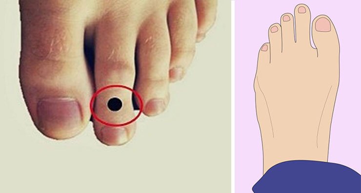 What It Means If The Second Toe Of Your Foot Is Longer