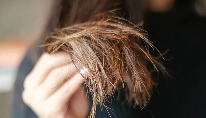 This Is How You Can Fix Hair Problems With Home Remedies