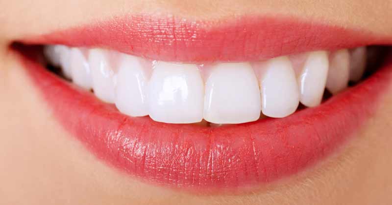How To Get White Teeth | Teeth Whitening
