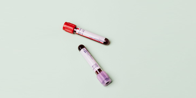 How to Correctly Interpret Blood Test Report - Decipher Lab Results Easily