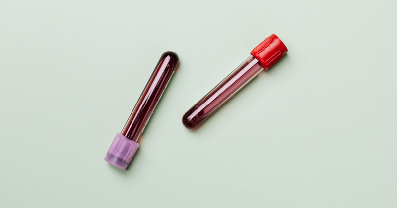 How to Correctly Interpret Blood Test Report - Decipher Lab Results Easily