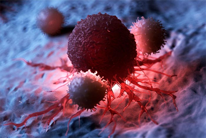 How Dangerous Is Cancer? Why Is Cancer So Deadly?