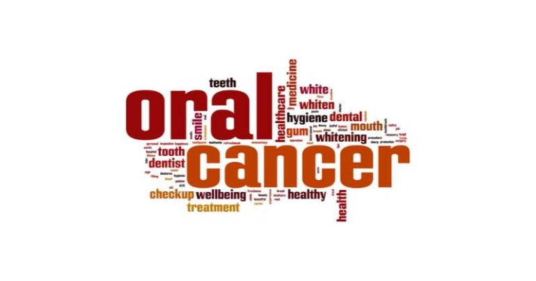 Oral Cancer: Signs, Symptoms, Causes, Types and Treatment