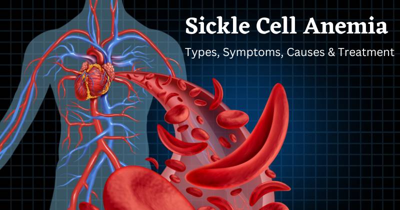 Sickle Cell Anemia: Types, Symptoms, Causes and Treatment