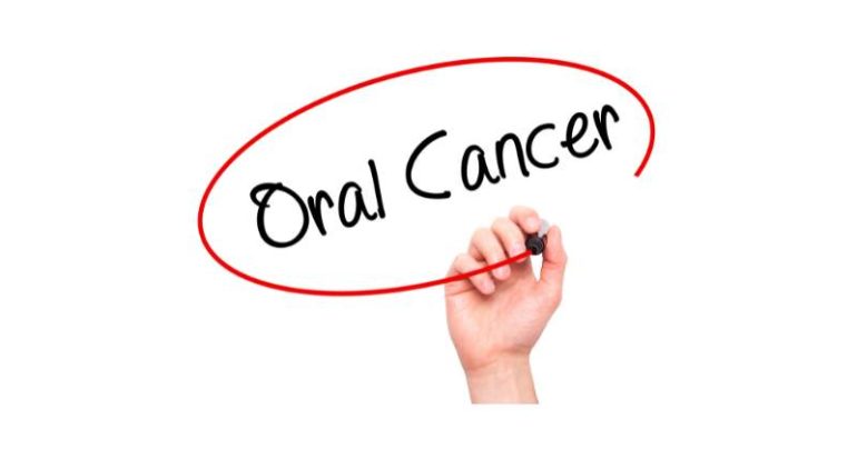 Oral Cancer: Signs, Symptoms, Causes, Types and Treatment