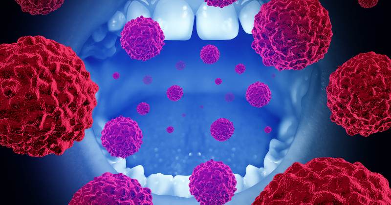 Oral Cancer: Signs, Symptoms, Causes, Types and Treatment