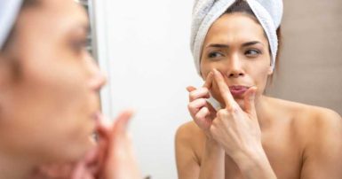 How to Lose Pimples on Face | How to Get Rid of Acne